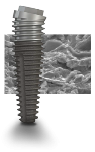 Southern Implants | Southern Implants