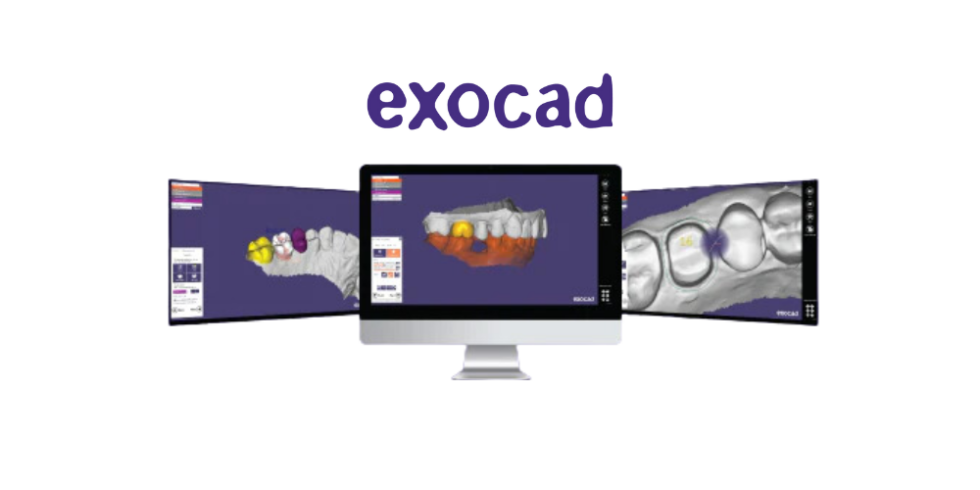 Exocad Download Page | Southern Implants