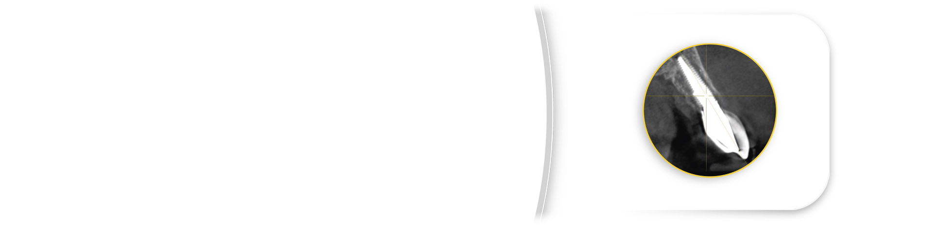 Southern Implants, Dental Implant Treatment Solutions, Innovative ...